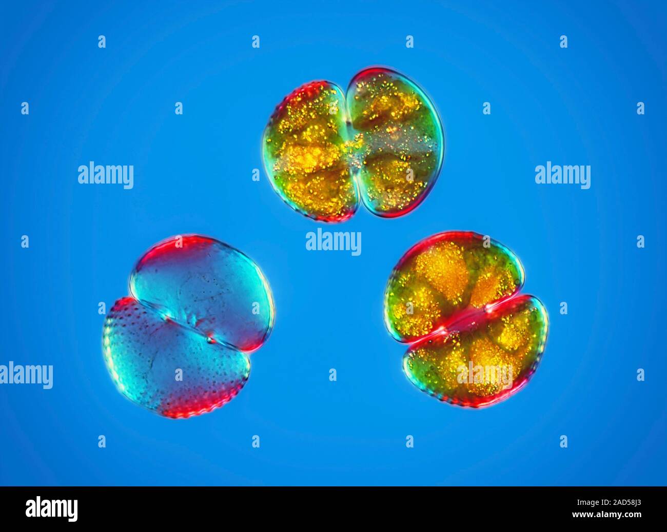 Cosmarium desmids. Polarised light micrograph of several Cosmarium sp ...