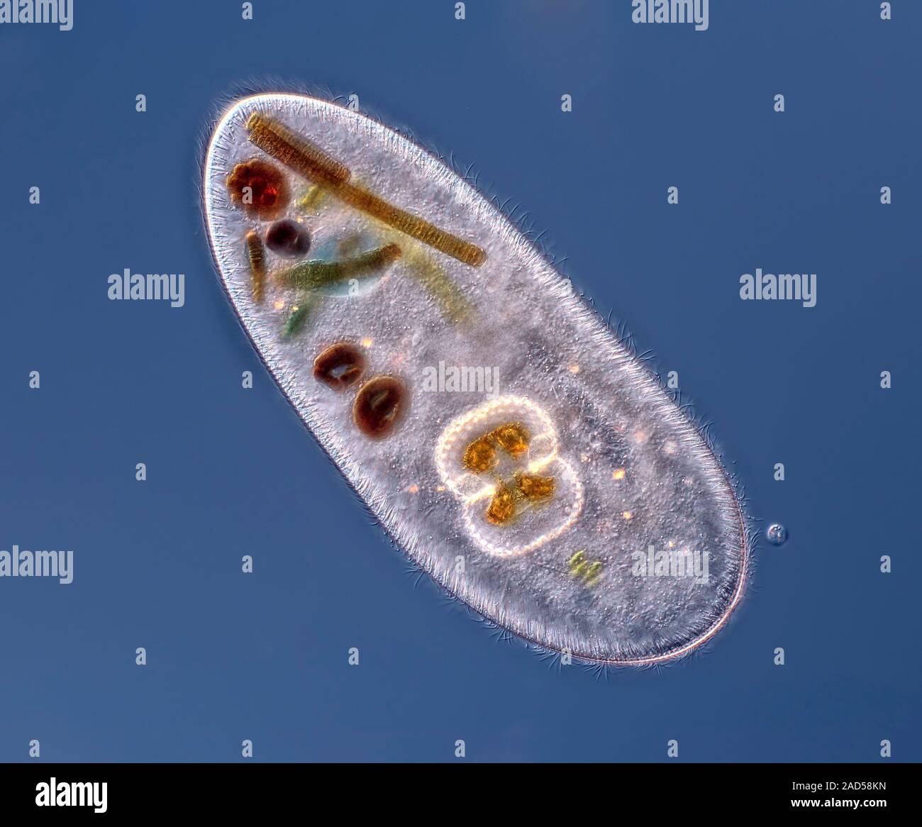 Frontonia sp. ciliate protozoan, light micrograph. A ciliate protozoan ...