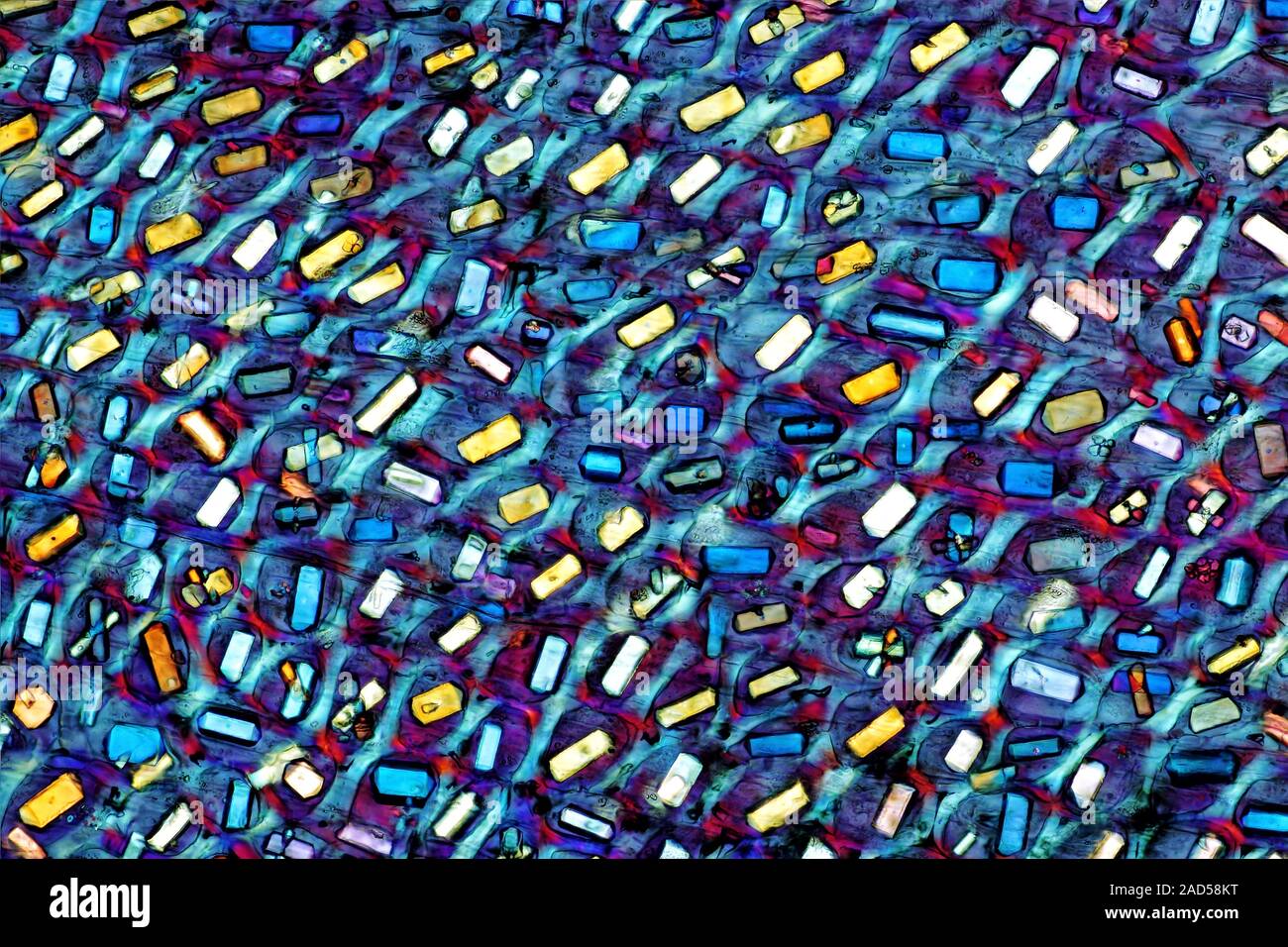 Raphides. Polarised light micrograph of tissue of garlic (Allium ...