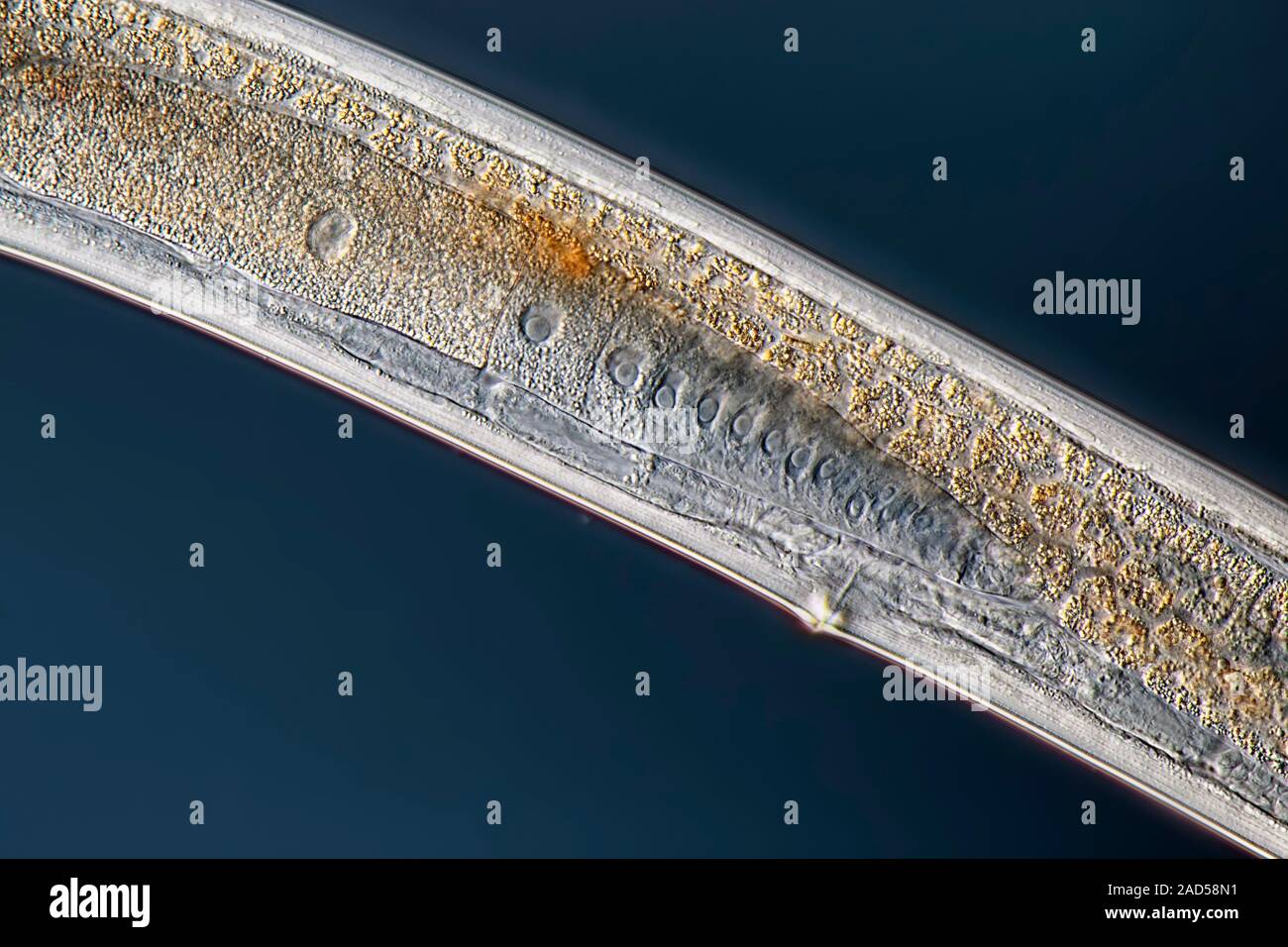 Nematode. Light micrograph of part of a nematode. Nematodes are small ...