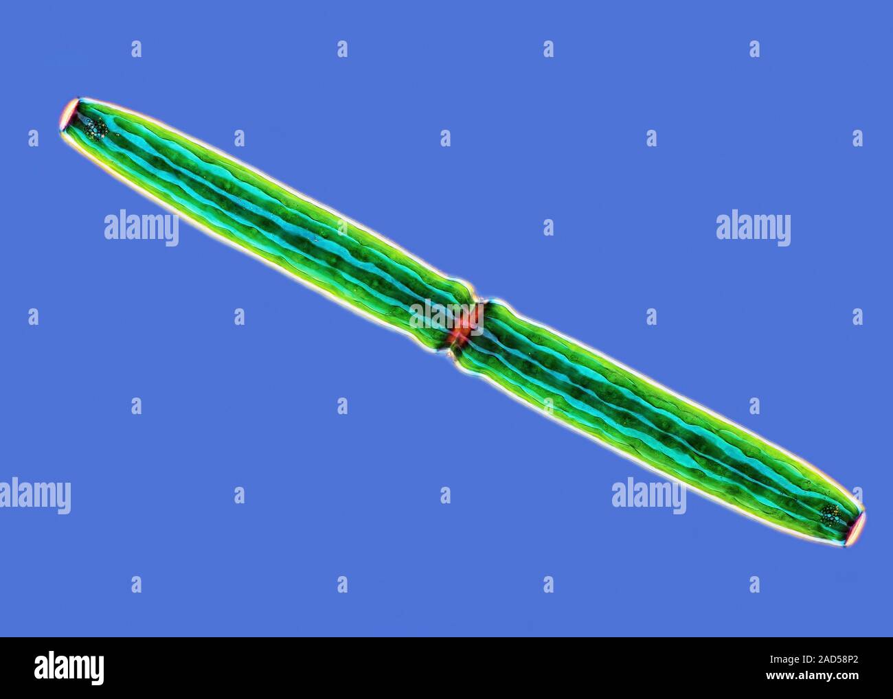 Pleurotaenium desmid. Polarised light micrograph of a Pleurotaenium sp ...
