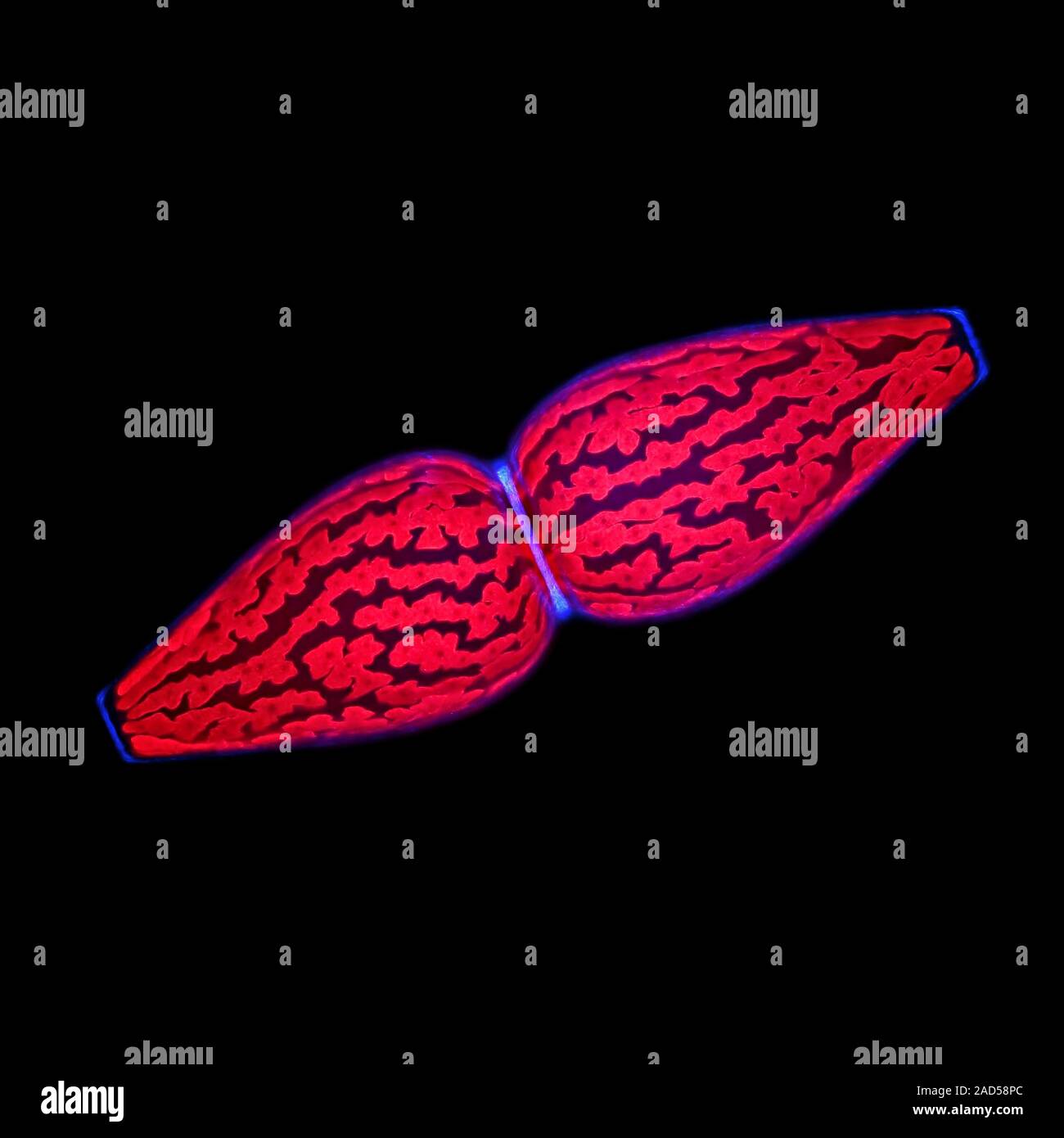 Pleurotaenium ovatum desmid. Fluorescence light micrograph of a ...
