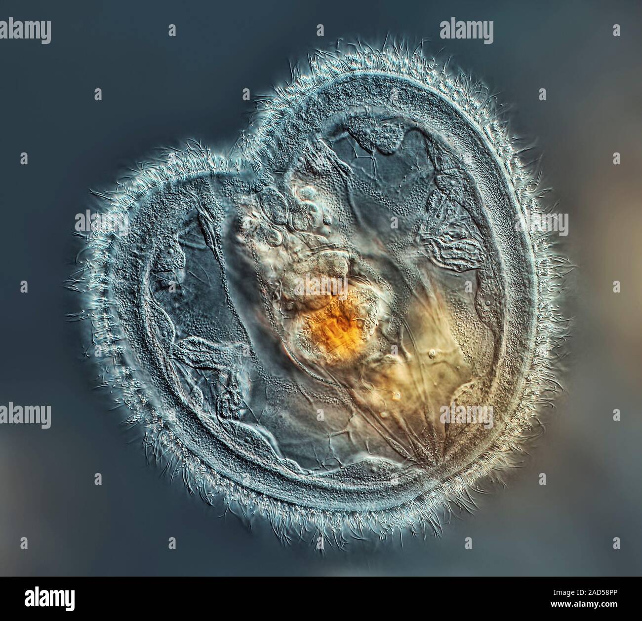 Rotifer, light micrograph. Rotifers (phylum Rotifera) are microscopic ...