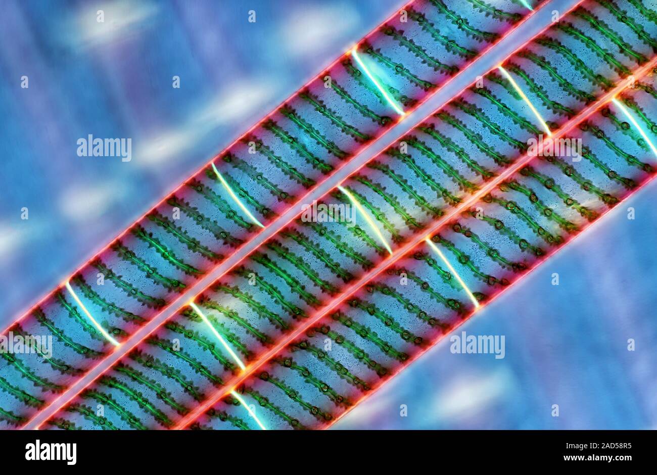 Spirogyra algae. Polarised light micrograph of Spirogyra sp. alga. This ...