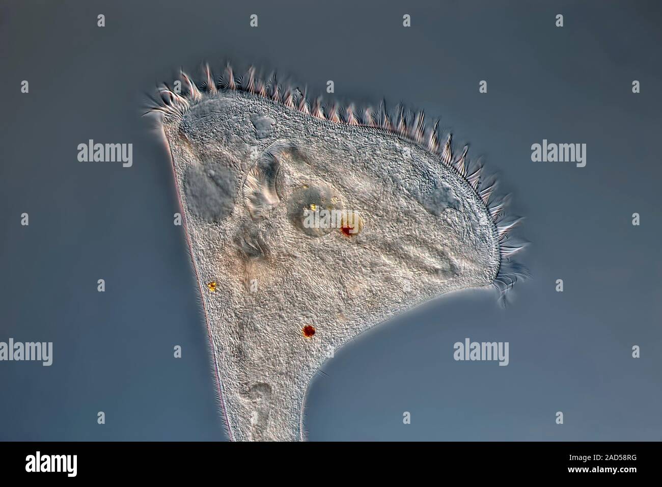 Stentor protozoan. Light micrograph of a Stentor sp. freshwater ciliate ...