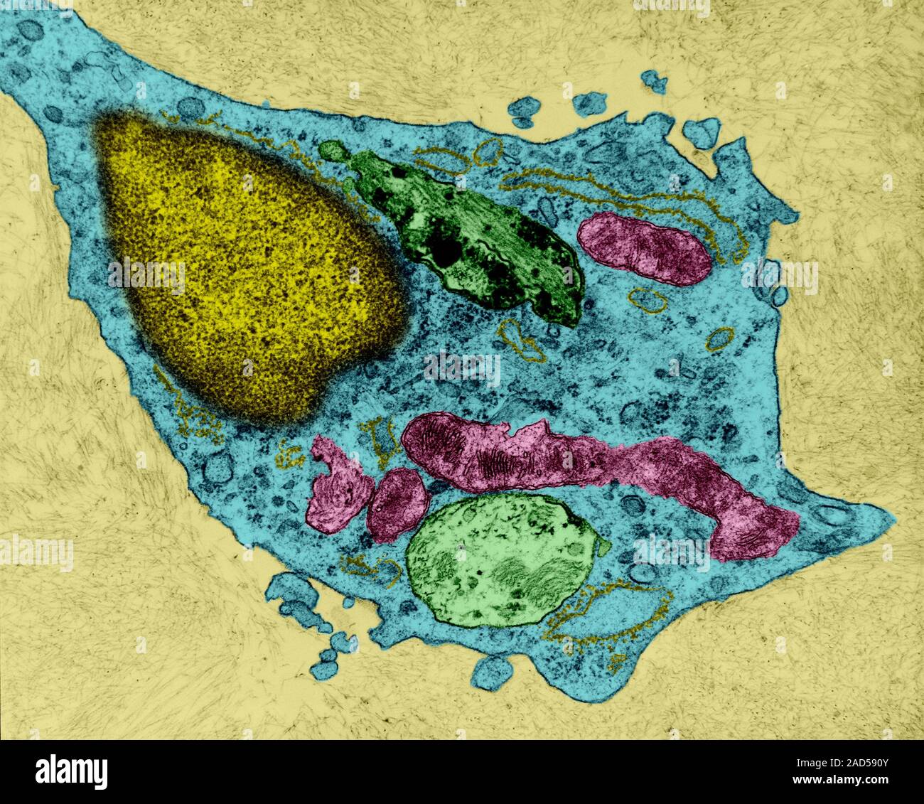 Neuroglia (microglia) cell destroying betaamyloid deposits by ...