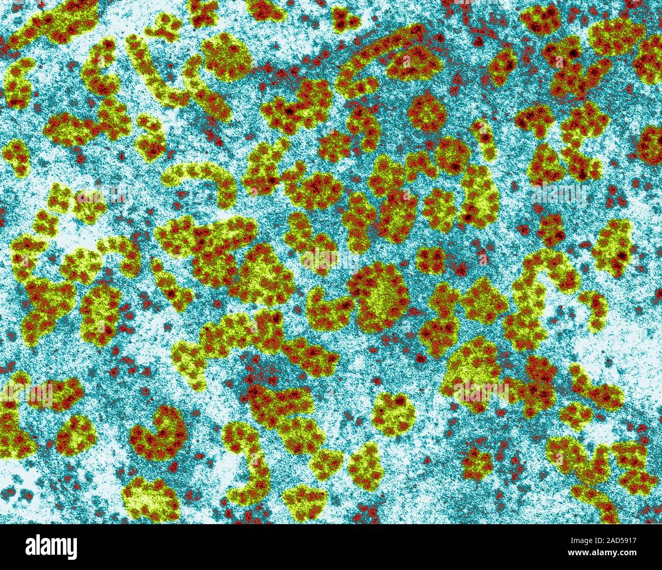 Ribosomes and polyribosomes (liver cell - hepatocyte), coloured ...
