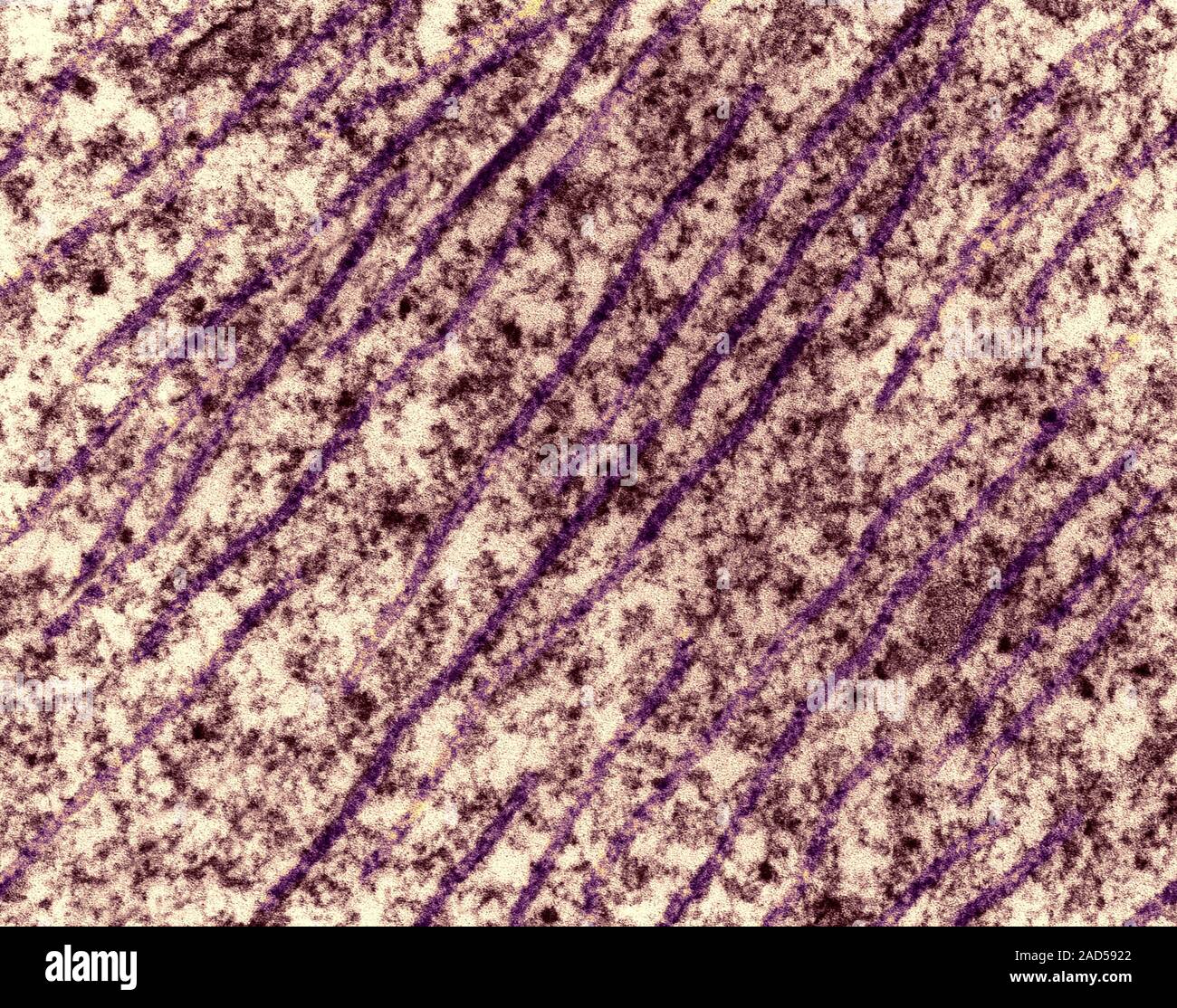 Microtubules in a neuron dendrite (central nervous system), coloured ...