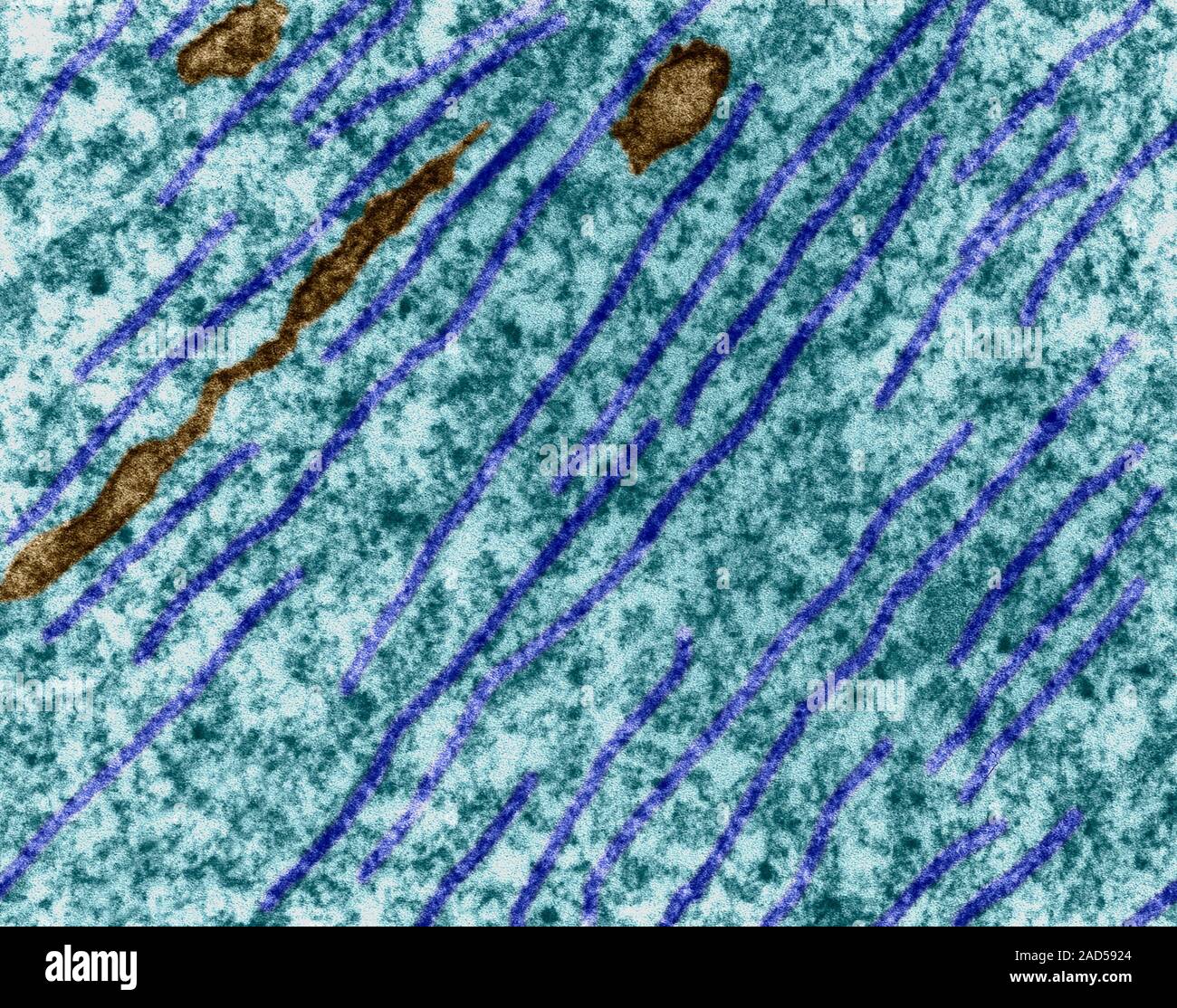 Microtubules in a neuron dendrite (central nervous system), coloured ...
