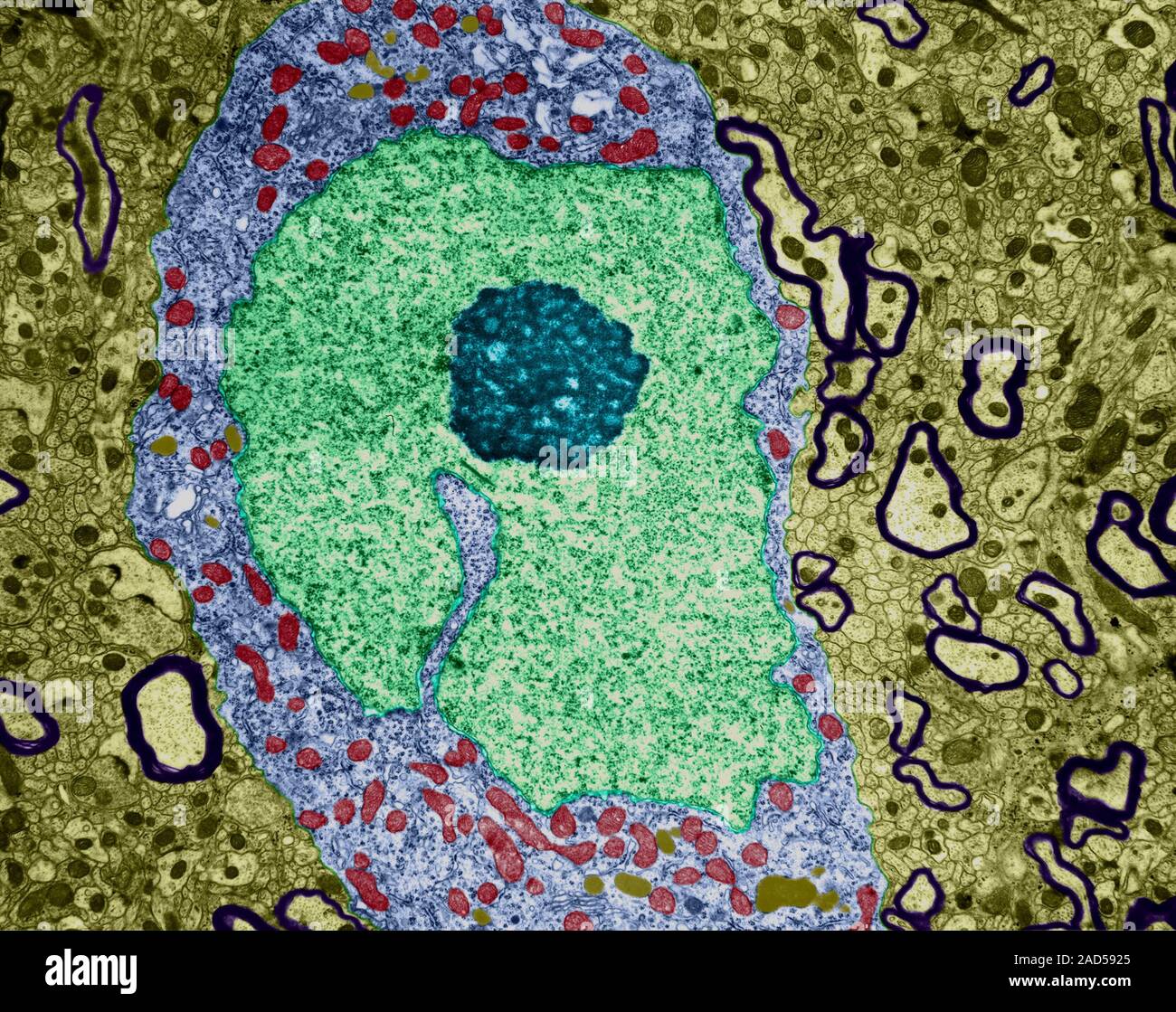 Neuron cell body with large nucleus and nucleolus (central nervous ...