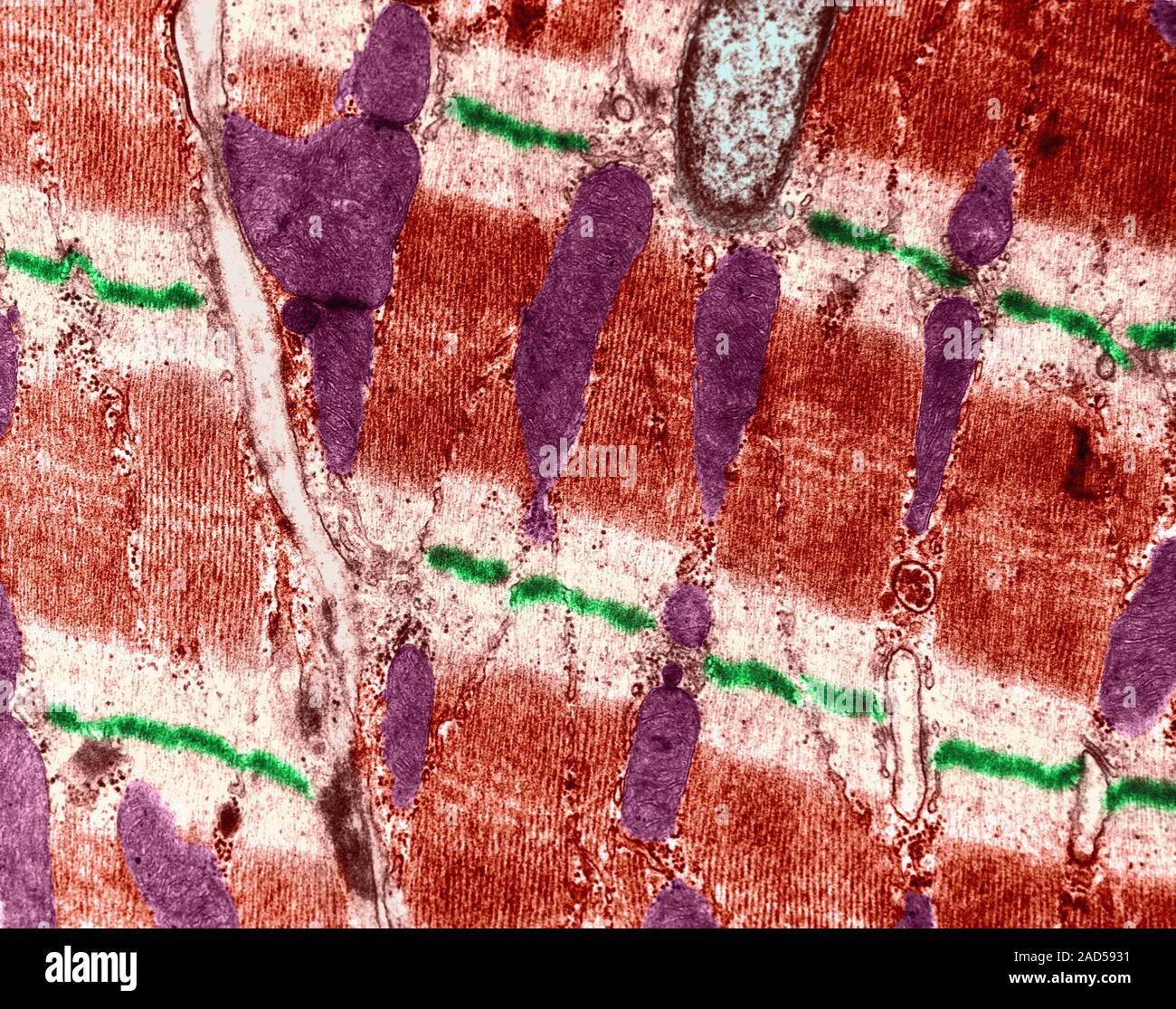 Heart muscle cell (human); nucleus, mitochondria, actin and myosin ...