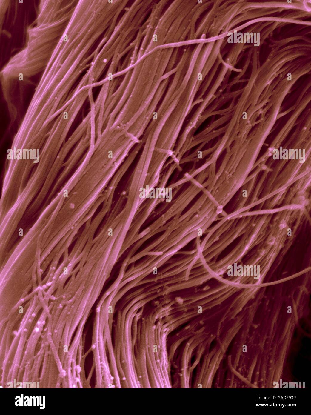 Collagen fibre bundle (connective tissue) in human heart muscle ...