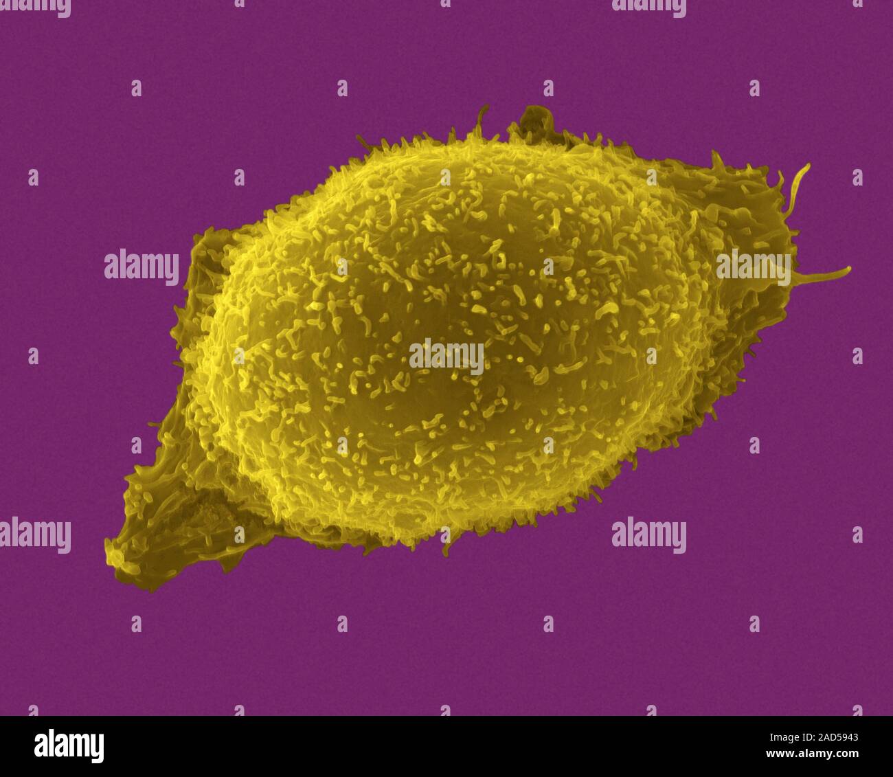 Mast cell, coloured scanning electron micrograph (SEM). A type of ...