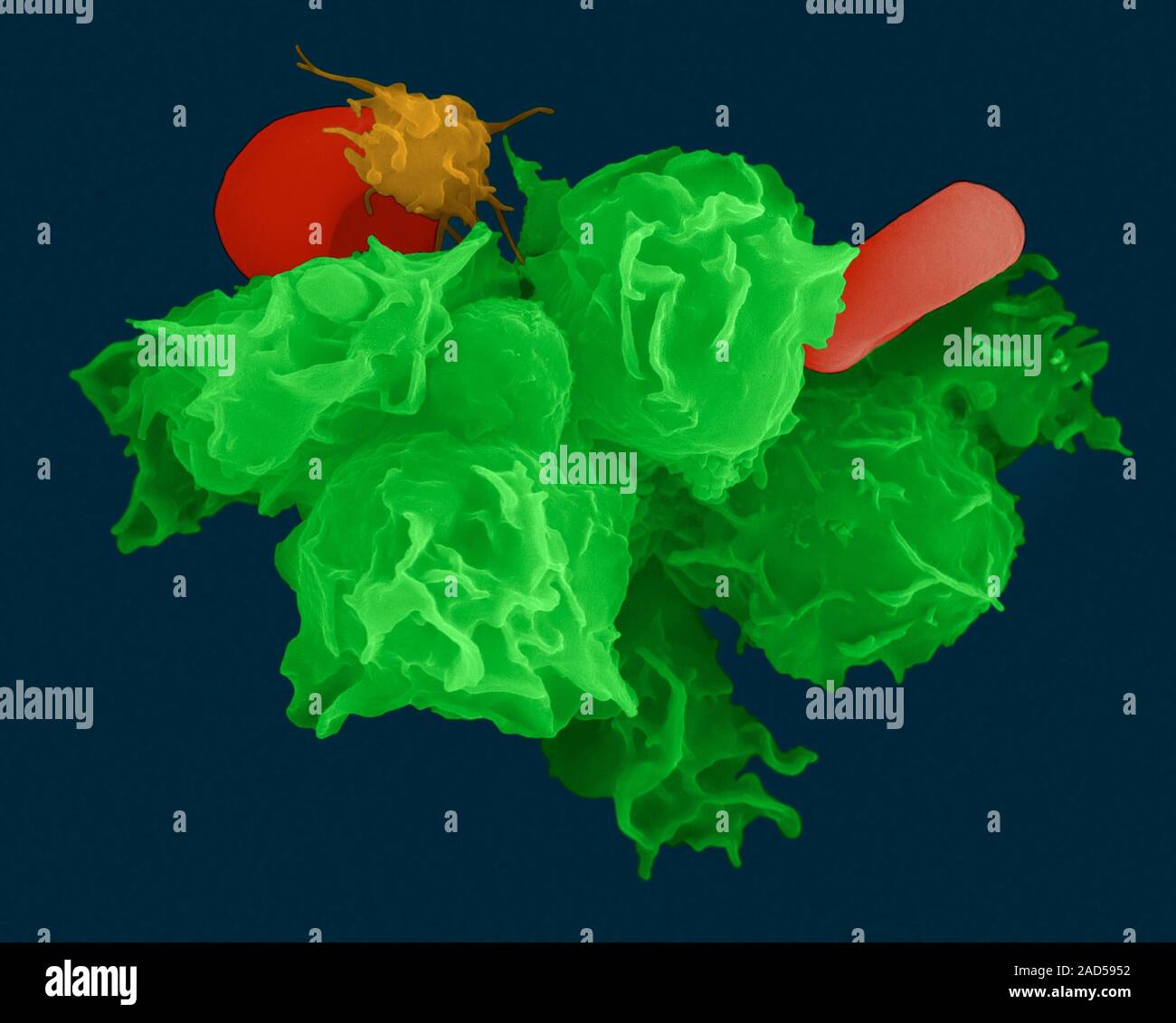 Granulocytic white blood cells (neutrophils), red blood cells and ...