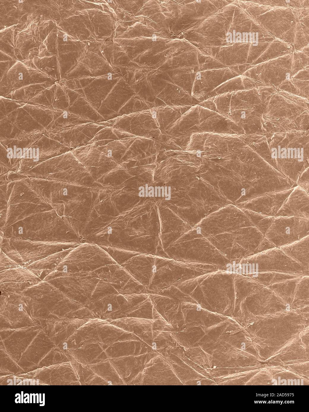 Human skin (epidermis), coloured scanning electron micrograph (SEM ...