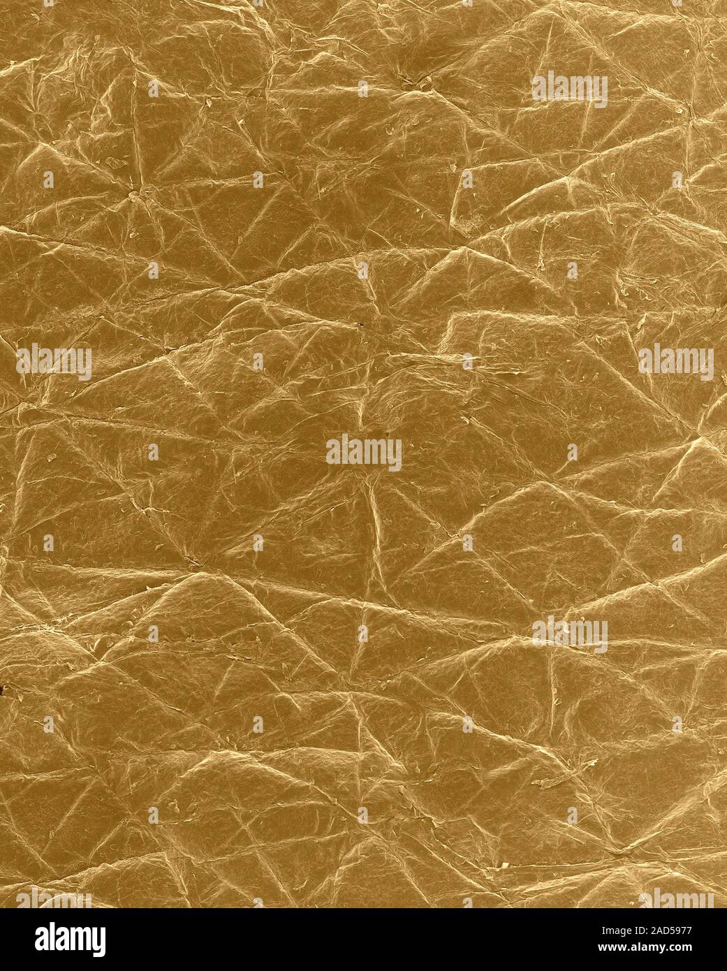 Human skin (epidermis), coloured scanning electron micrograph (SEM ...