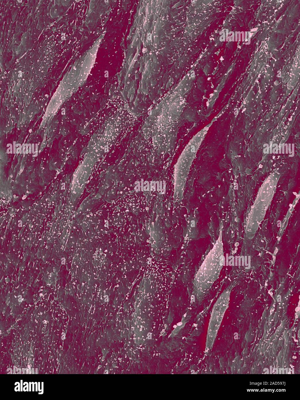 Aorta (artery) inner endothelial cell surface, coloured scanning ...