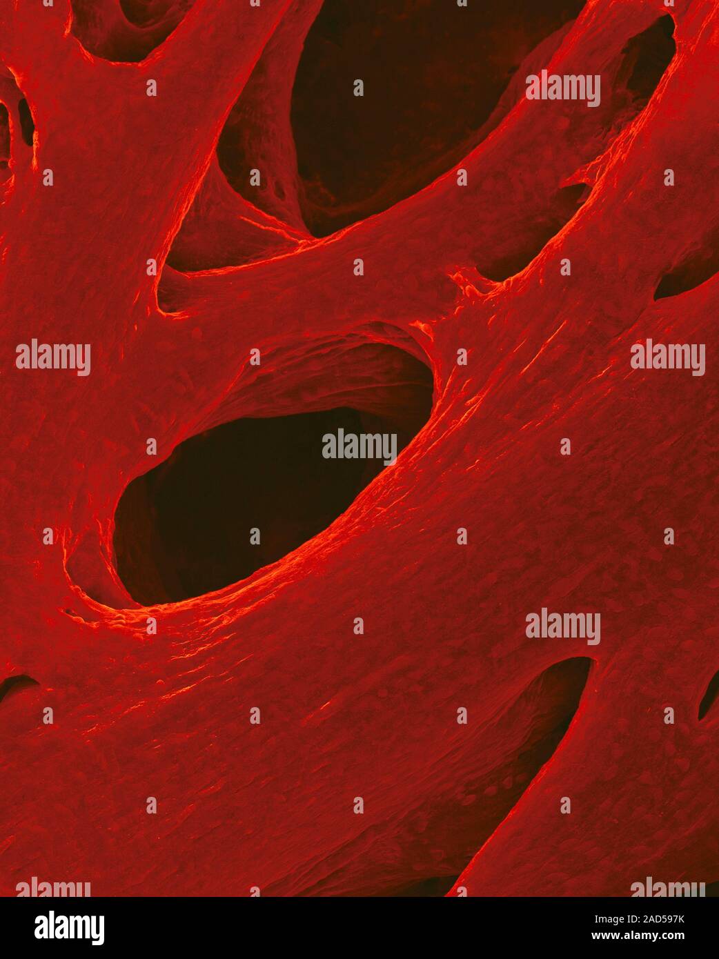 Heart Atrium Cardiac Muscle Bundles Mammal Coloured Scanning