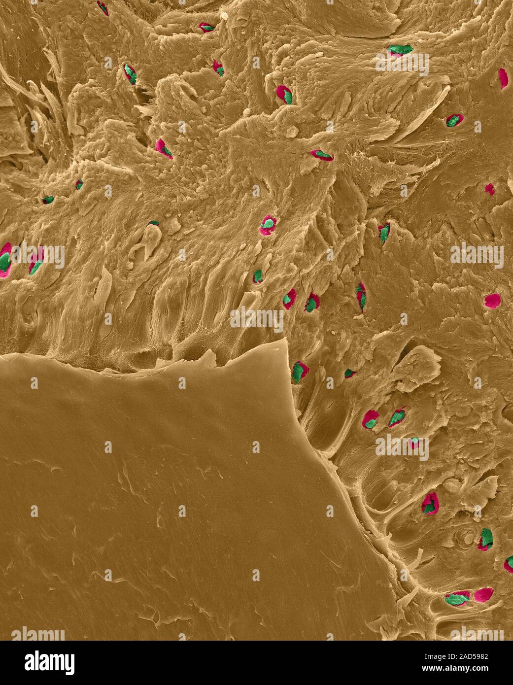 Bone cells (osteocytes, green) in bone lacunae (pink) from a fractured ...