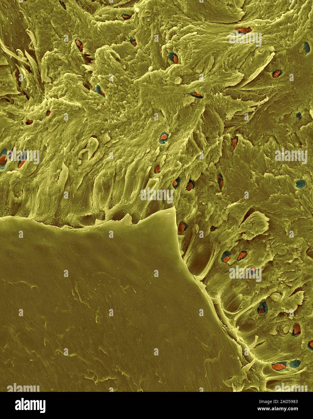 Bone cells (osteocytes, orange) in bone lacunae (blue) from a fractured ...