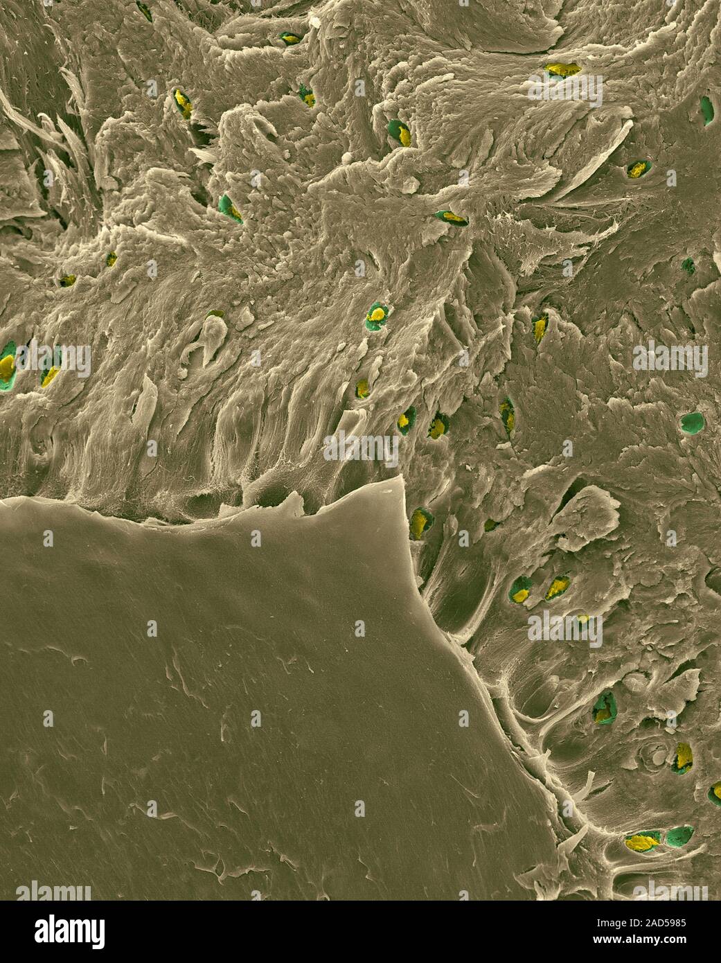 Bone cells (osteocytes, yellow) in bone lacunae (green) from a ...