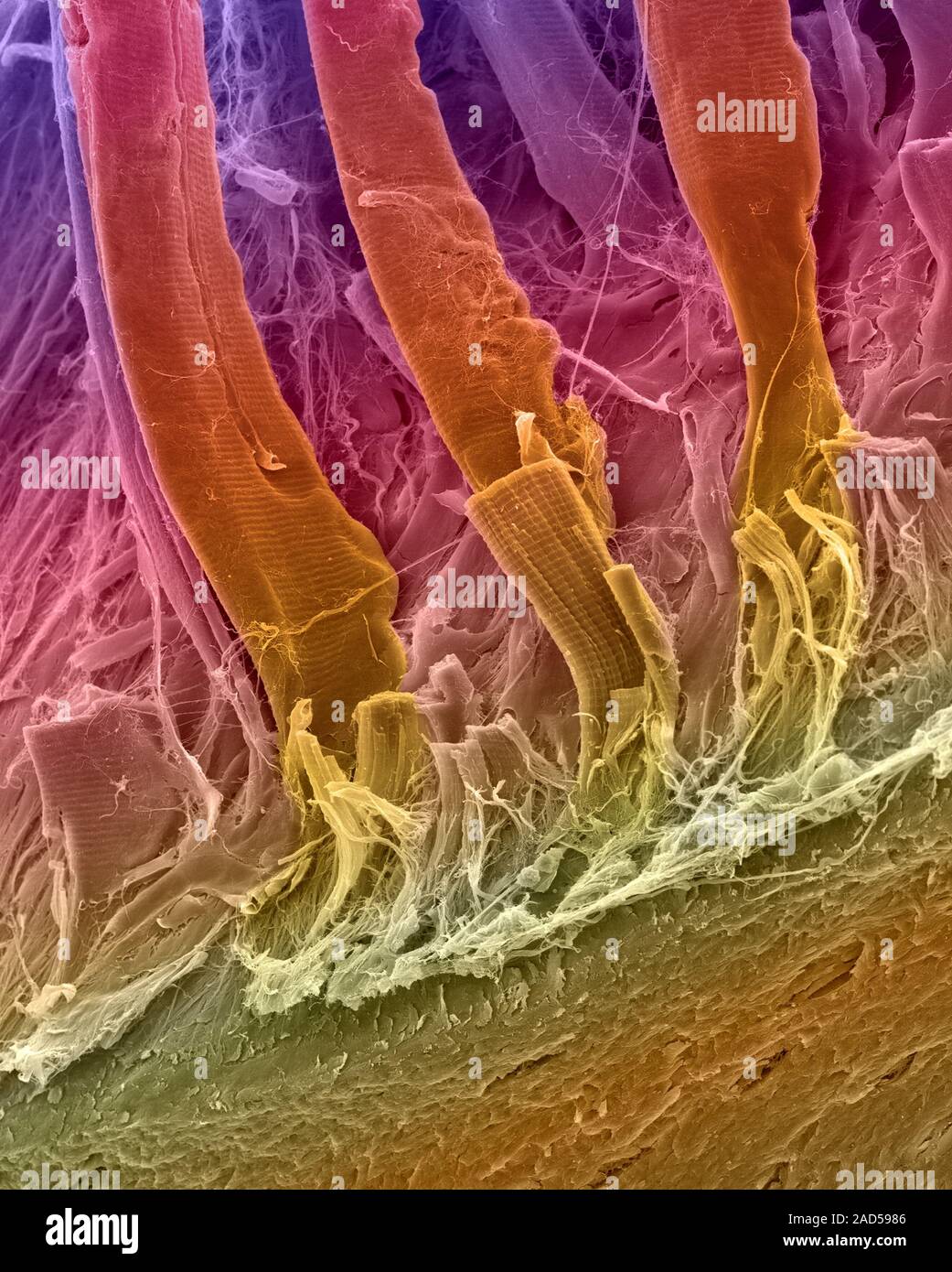 Tendons and other connective tissue attached to a bone surface ...