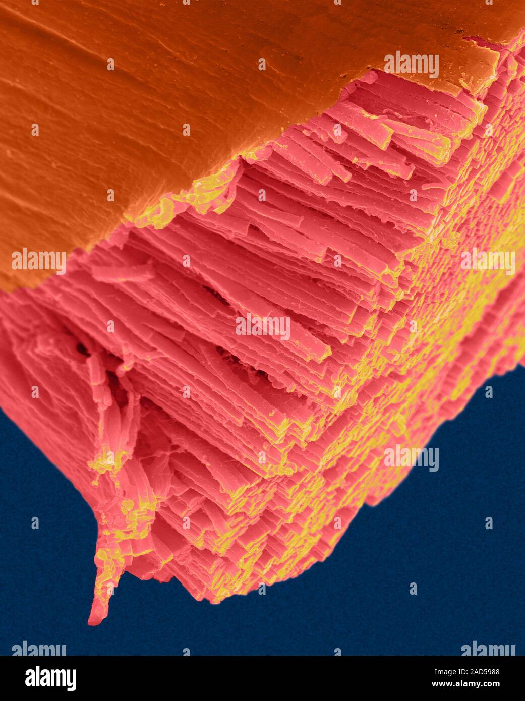 Skeletal muscle fibre with exposed intracellular actin myosin filaments, coloured scanning ...