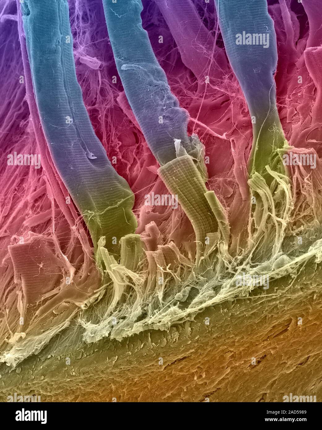 Tendons and other connective tissue attached to a bone surface ...