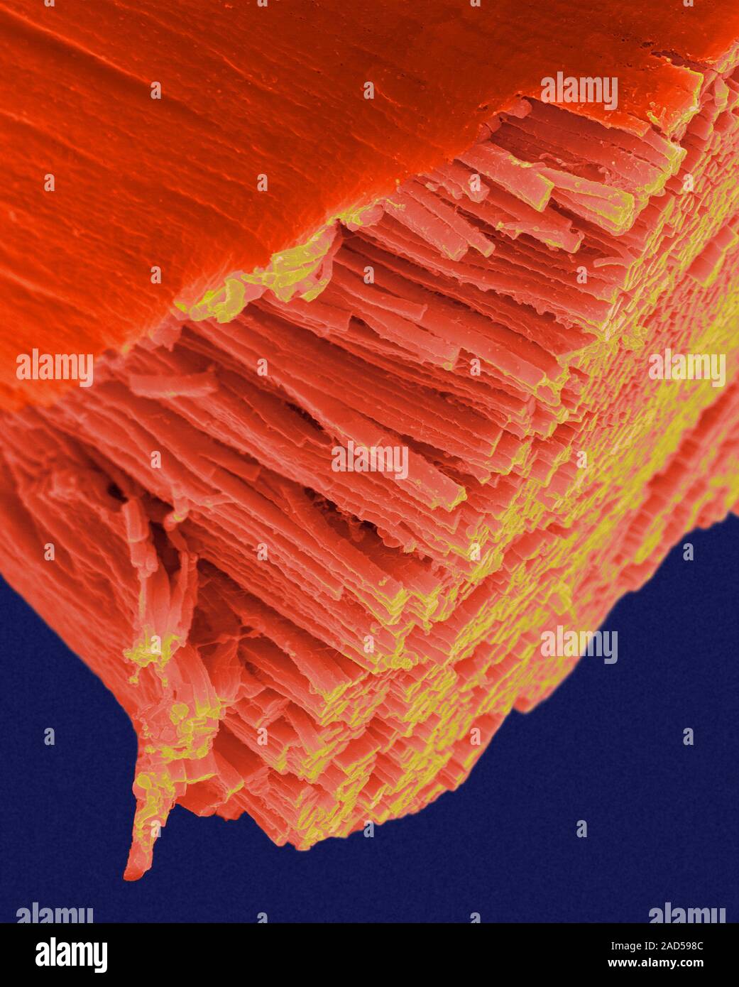 Skeletal muscle fibre with exposed intracellular actin myosin filaments, coloured scanning ...