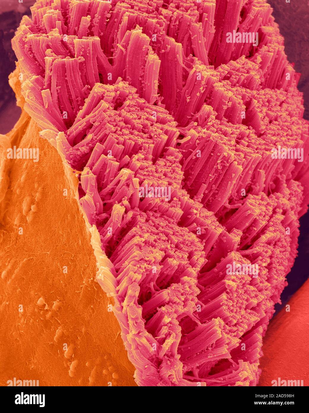 Skeletal muscle fibre with exposed intracellular actin myosin filaments, coloured scanning ...