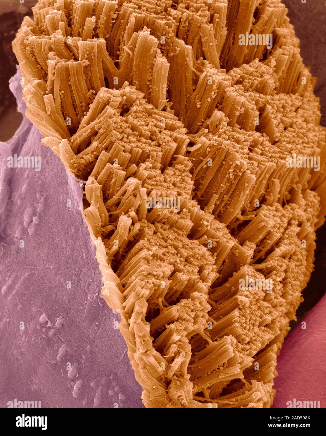 Skeletal muscle fibre with exposed intracellular actin myosin filaments ...