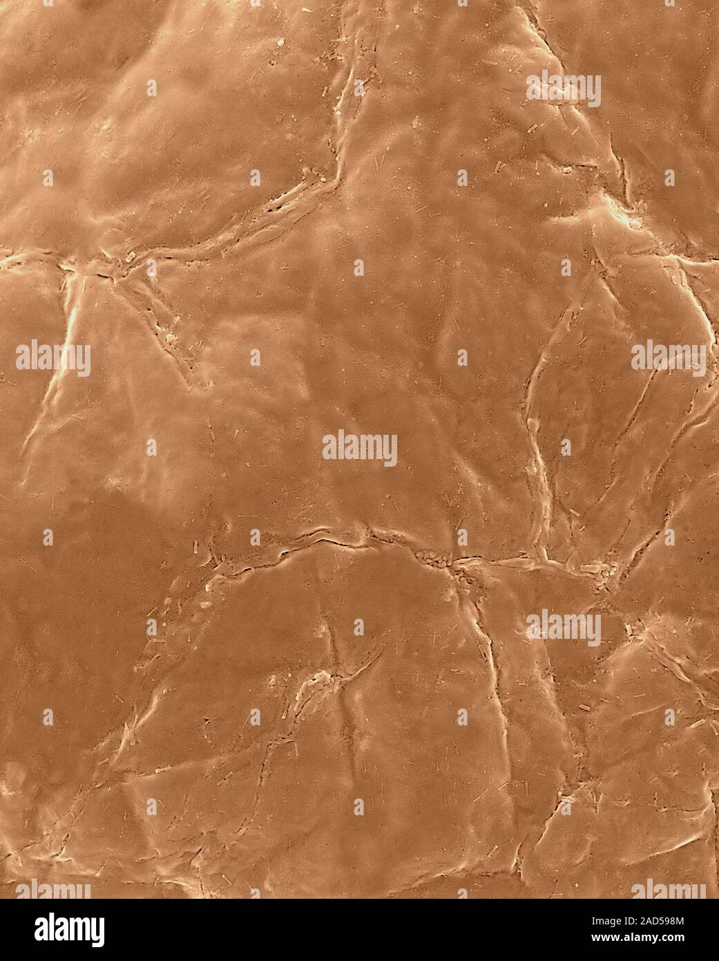 Human skin (epidermis), coloured scanning electron micrograph (SEM ...