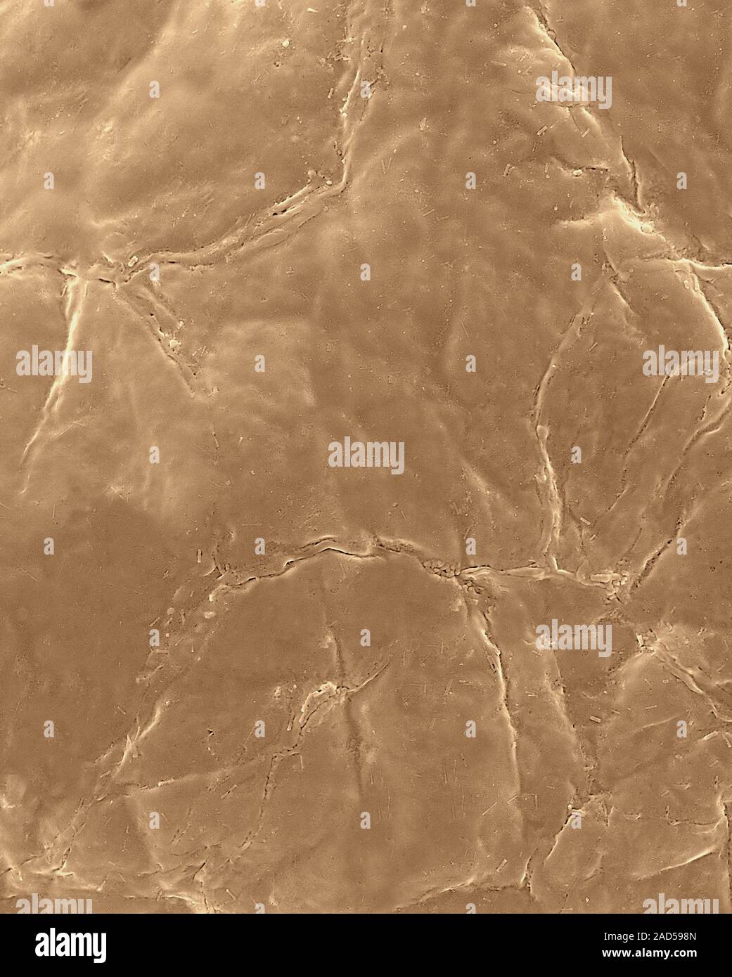 Human skin (epidermis), coloured scanning electron micrograph (SEM ...
