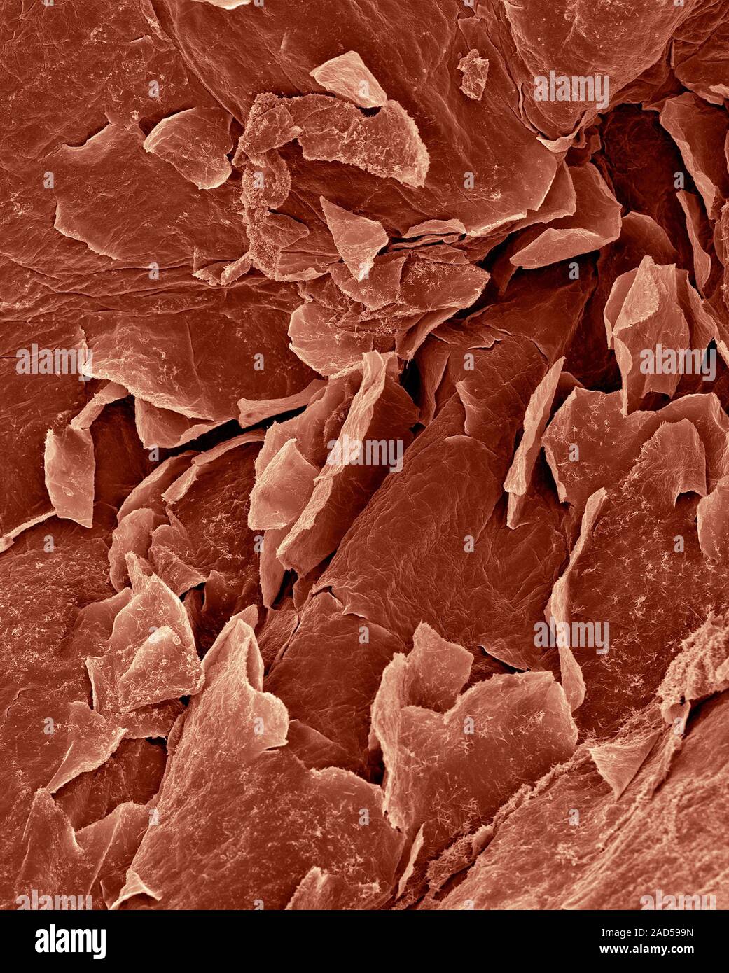 Human skin (epidermis), coloured scanning electron micrograph (SEM ...