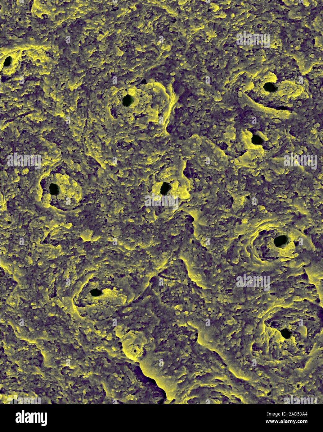 Dentin region of a human tooth with canals or dentinal tubules (dental ...