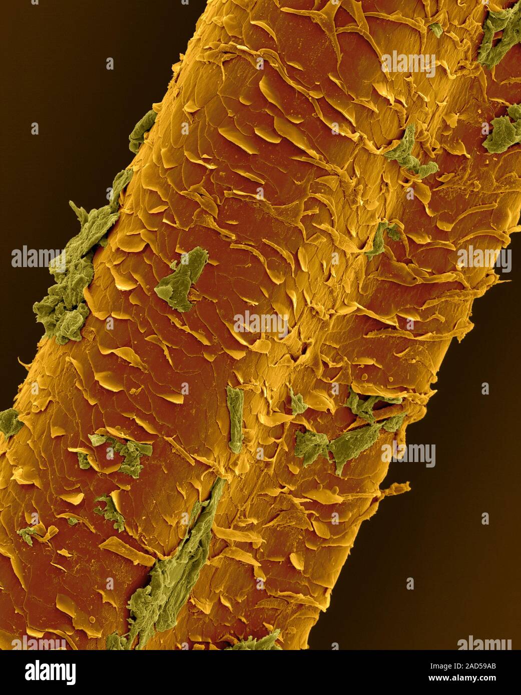 Human hair with damaged cuticle, coloured scanning electron micrograph ...