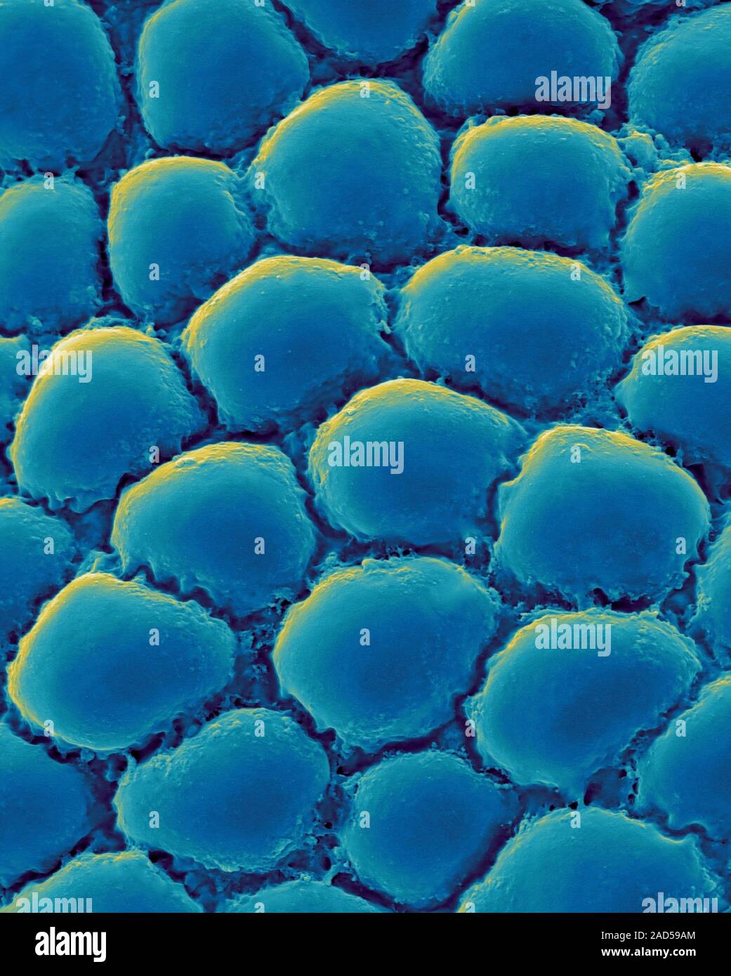 Adipose Connective Tissue Composed Mainly Of Adipocytes Fat Cells Coloured Scanning Electron