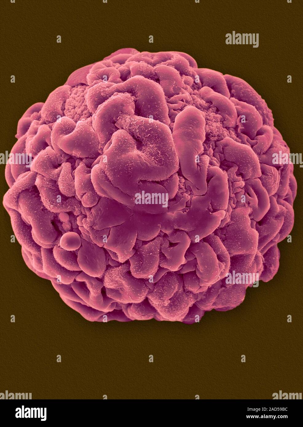 Muscle myoblast sphere grown from a single muscle (myoblast) stem cell ...