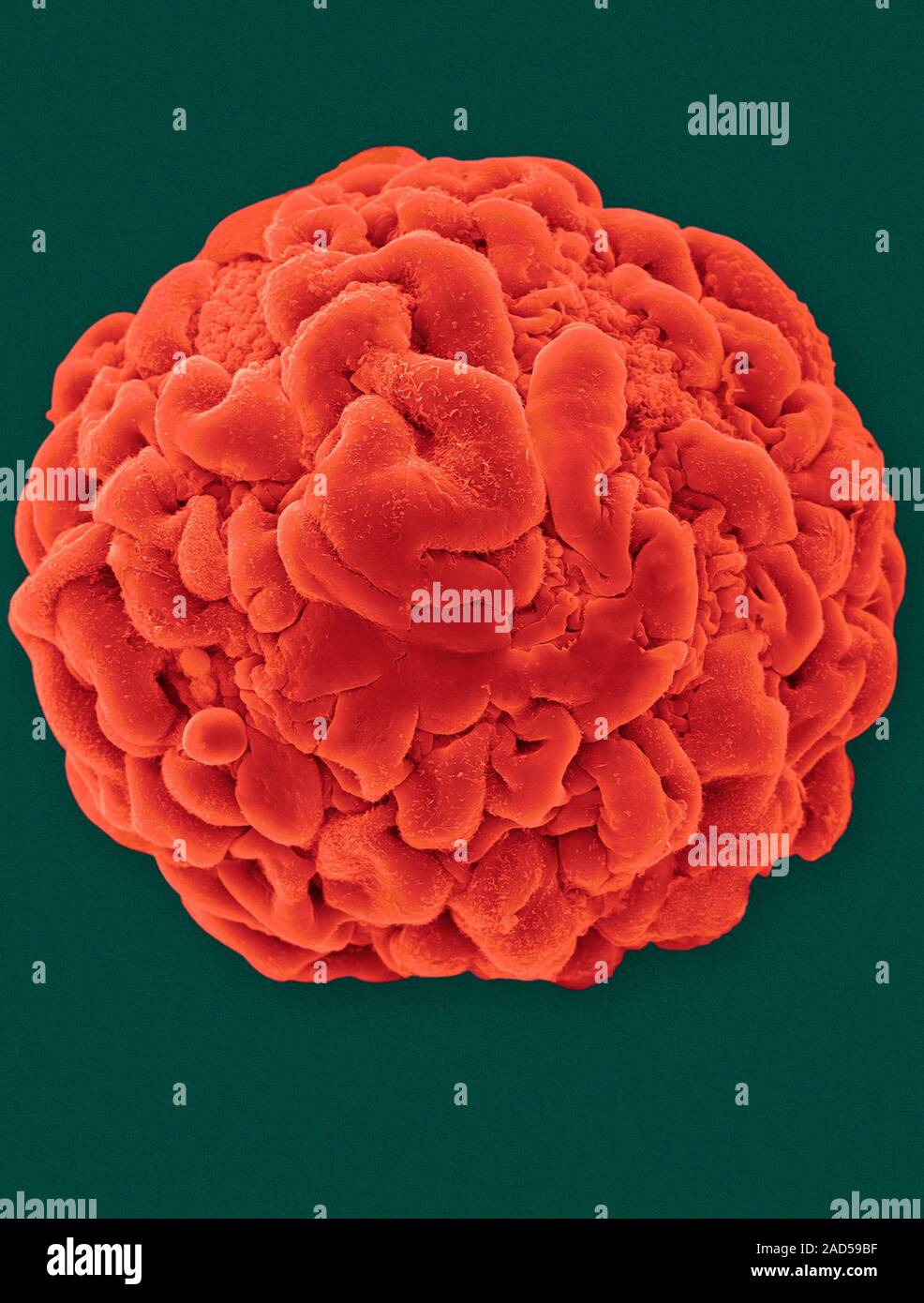 Muscle myoblast sphere grown from a single muscle (myoblast) stem cell ...