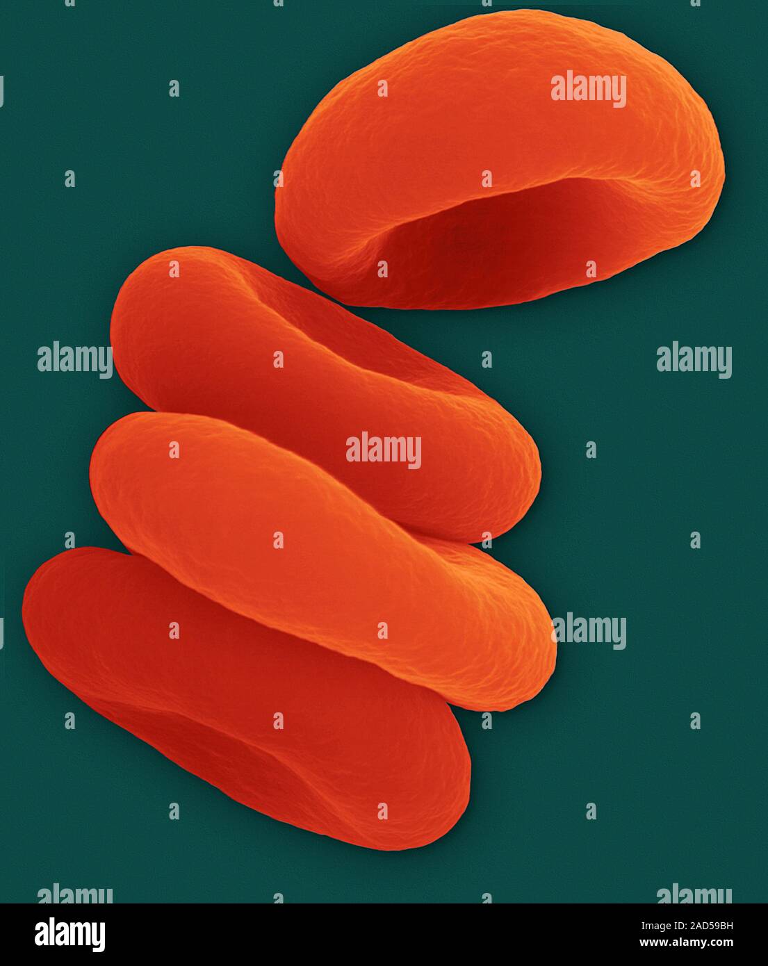 Red blood cells in the Rouleau formation, coloured scanning electron ...