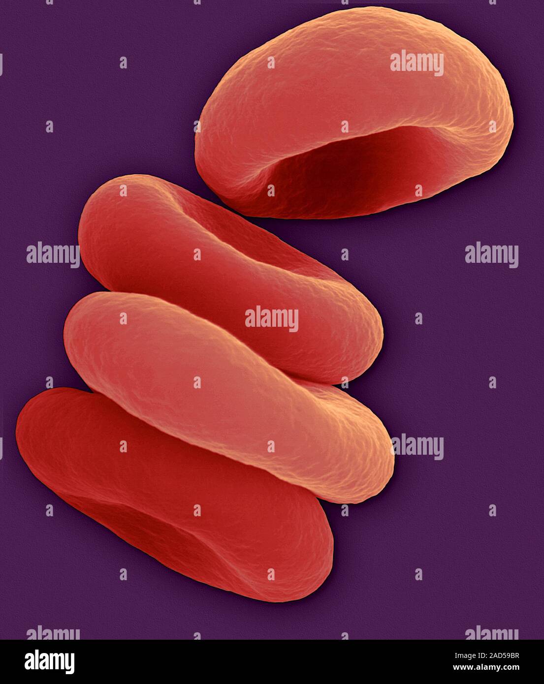 Red blood cells in the Rouleau formation, coloured scanning electron ...