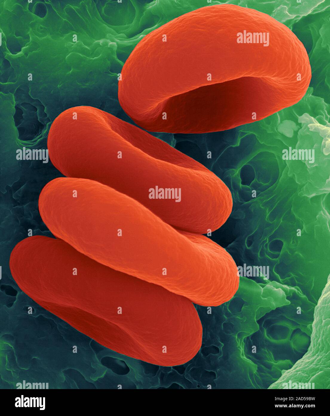 Red blood cells in the Rouleau formation, coloured scanning electron ...