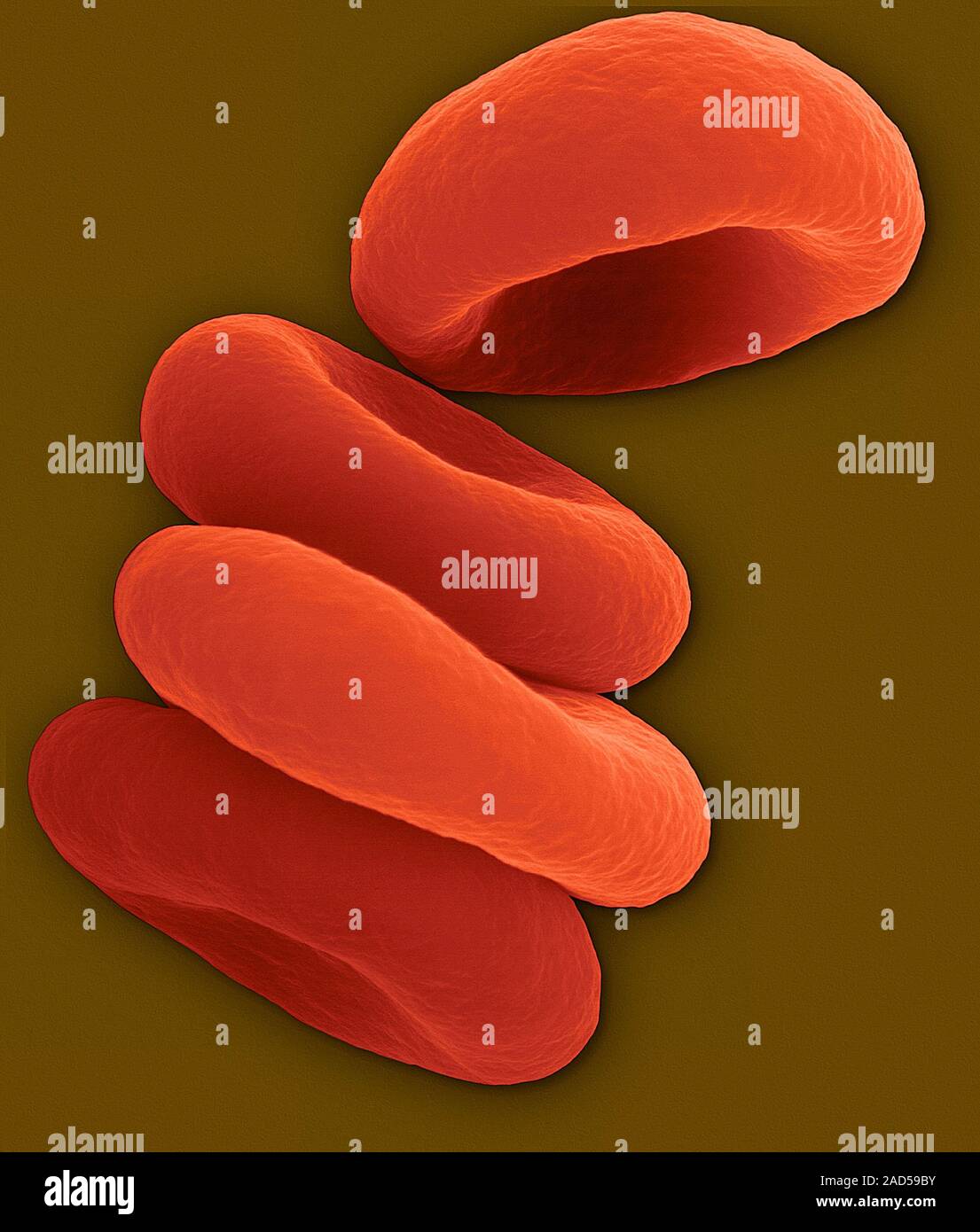 Red blood cells in the Rouleau formation, coloured scanning electron ...