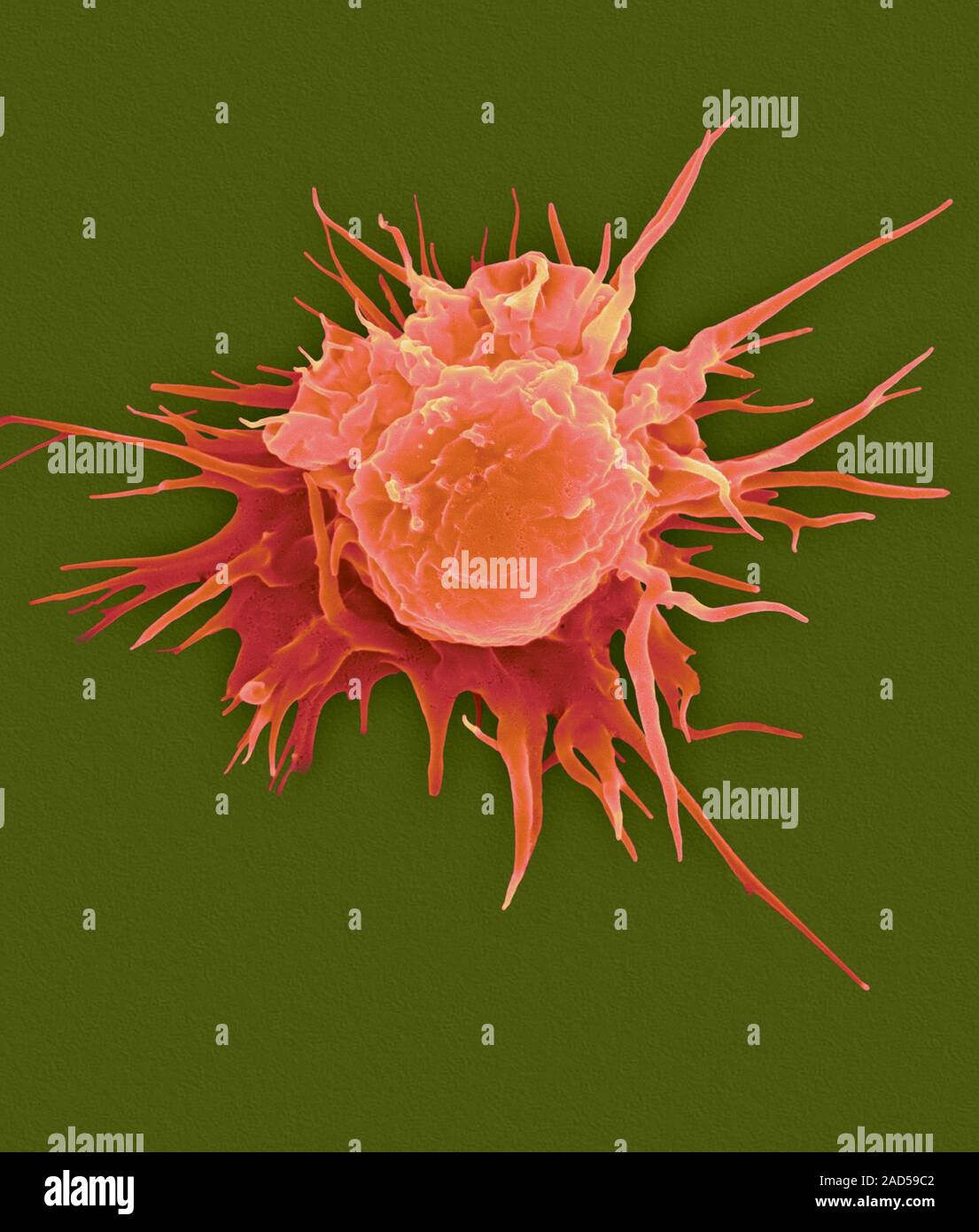 Alveolar tissue macrophage with short filopodia, coloured scanning ...