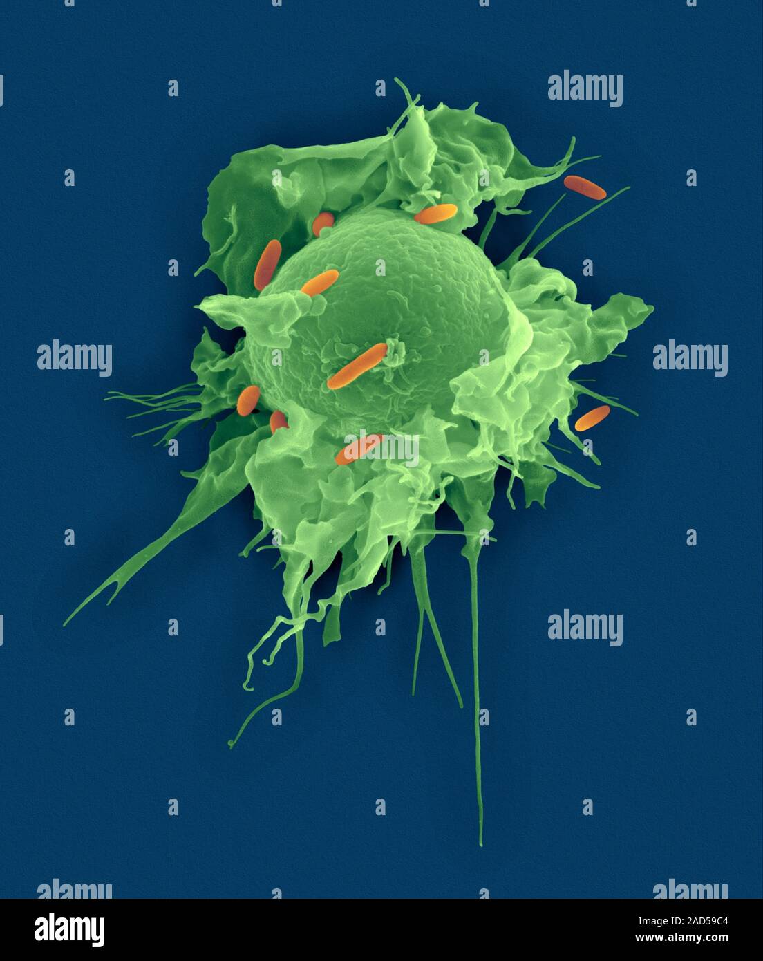 Alveolar tissue macrophage phagocytosis of E. coli, coloured scanning ...