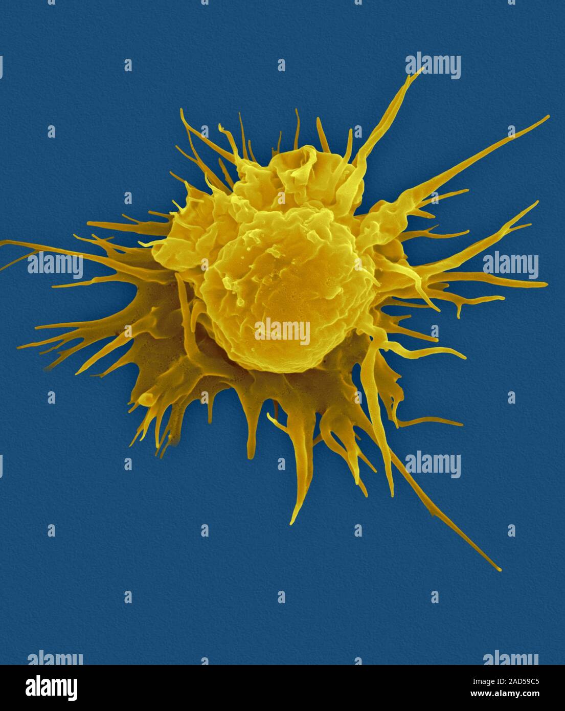 Alveolar tissue macrophage with short filopodia, coloured scanning ...
