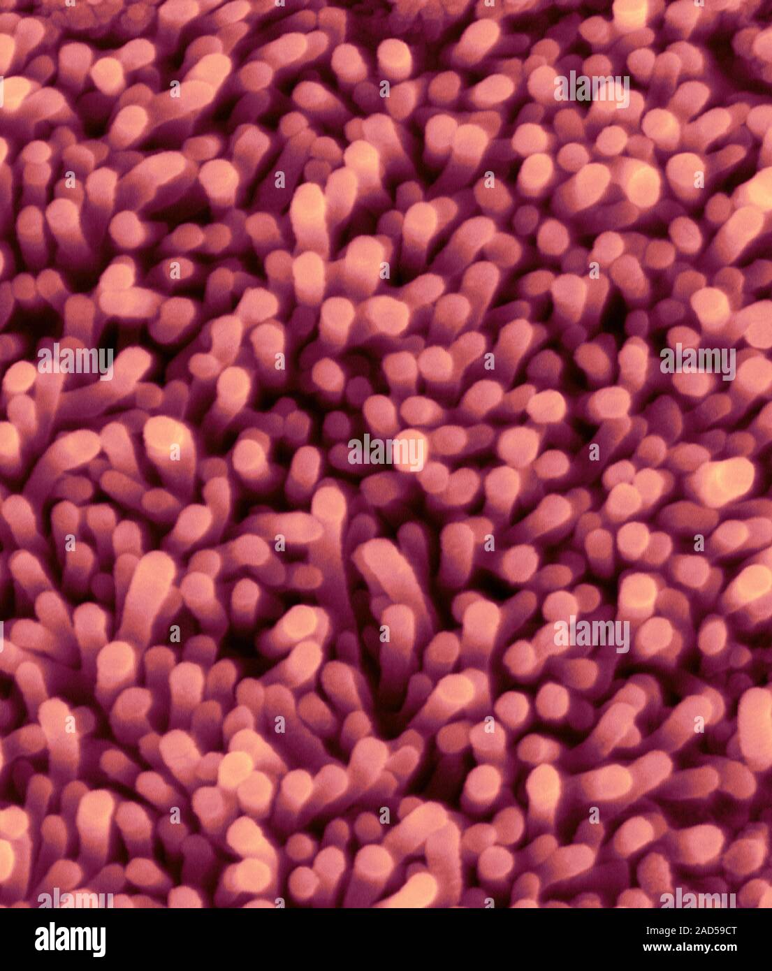 Nasopharynx surface, coloured scanning electron micrograph (SEM). Shown ...