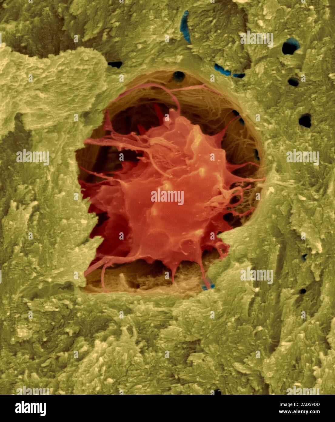 Bone cell (osteocyte, pink-purple) in a bone lacuna (light orange) from ...