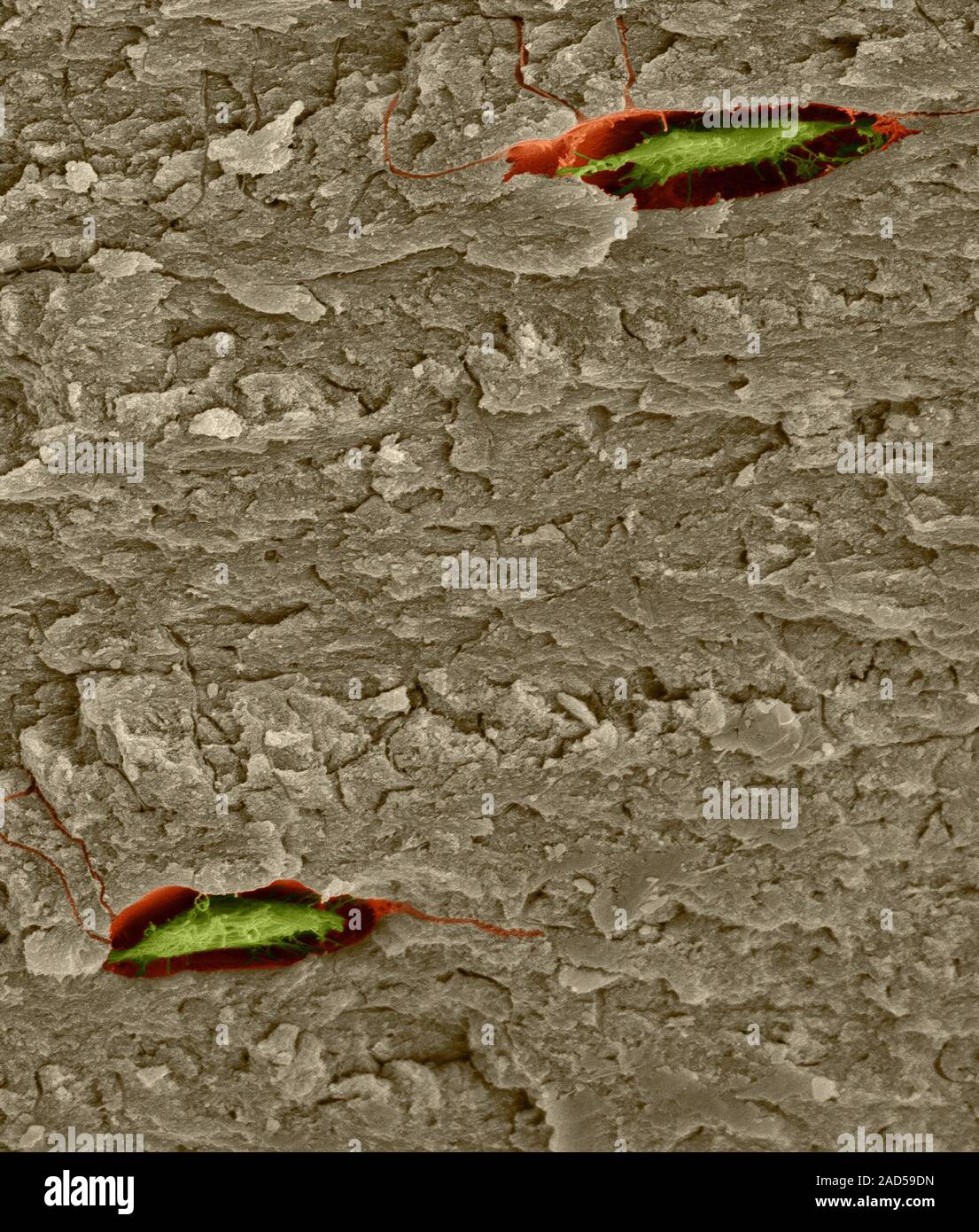 Bone cells (osteocytes, yellow) in two bone lacunae (orange) from a ...