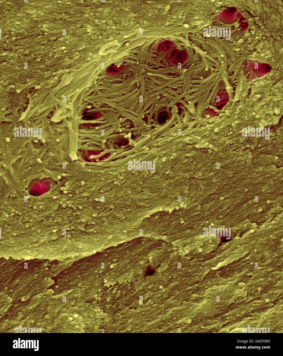 Bone lacuna and canaliculi from a fractured compact bone, coloured ...